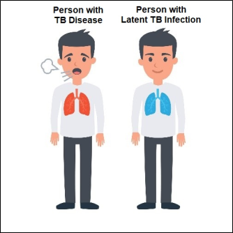 Differences Between Latent TB Infection and TB Disease
