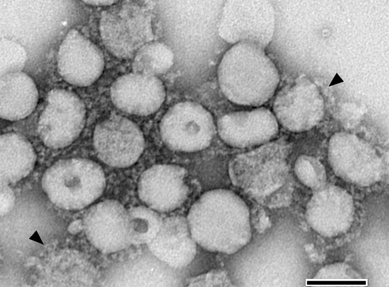 Remembering SARS 10 Years Later About CDC