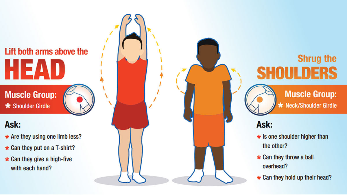 Restored CDC | Evaluating Proximal Muscle Weakness | Acute Flaccid ...