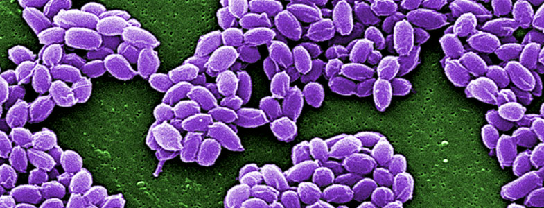 About Anthrax | Anthrax | CDC