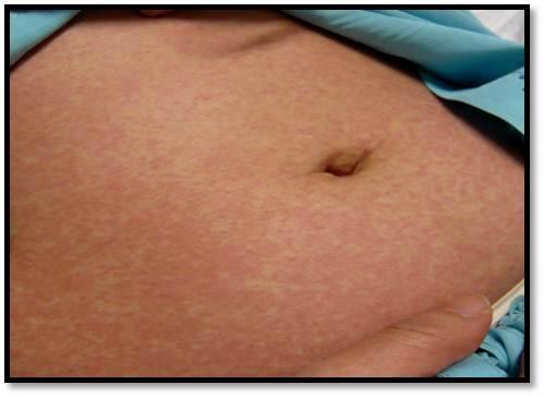 Physical Examination Findings — Recovery Phase