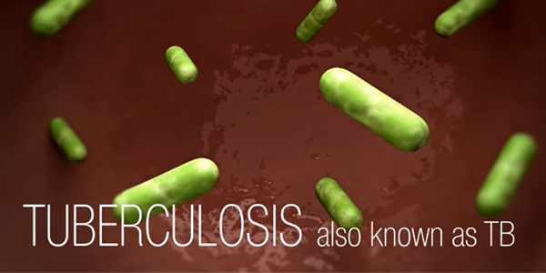 CDC Tuberculosis (TB) Transmission and Pathogenesis Video