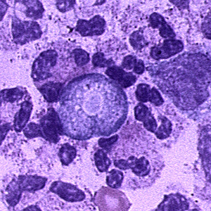 CDC - DPDx - Free Living Amebic Infections