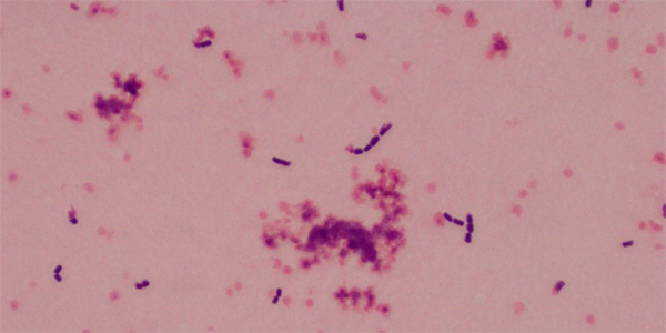 Fatal Sepsis Associated with Bacterial Contamination of Platelets ...