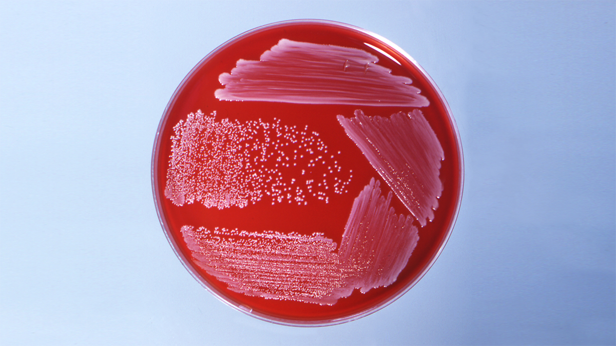 Notes from the Field: Conjunctivitis Caused by Toxigenic ...