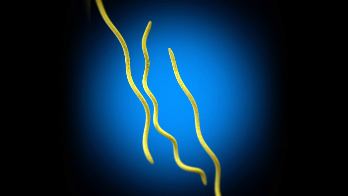 Updated CDC Recommendation for Serologic Diagnosis of Lyme Disease | MMWR