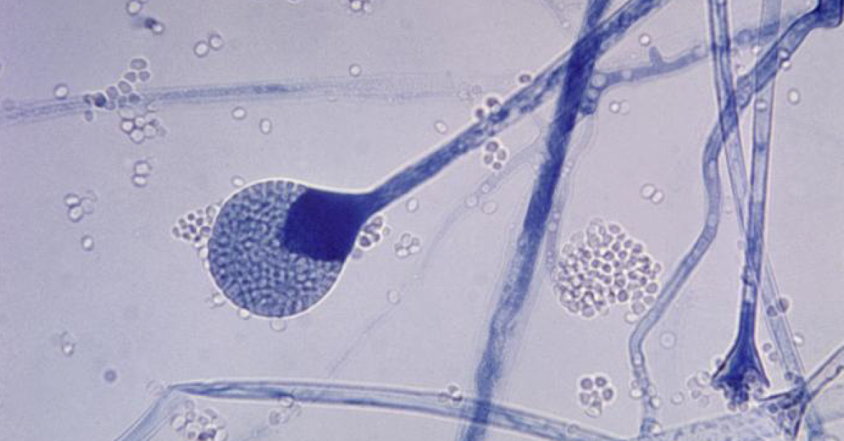 Notes from the Field: Mucormycosis Cases During the COVID-19 Pandemic ...