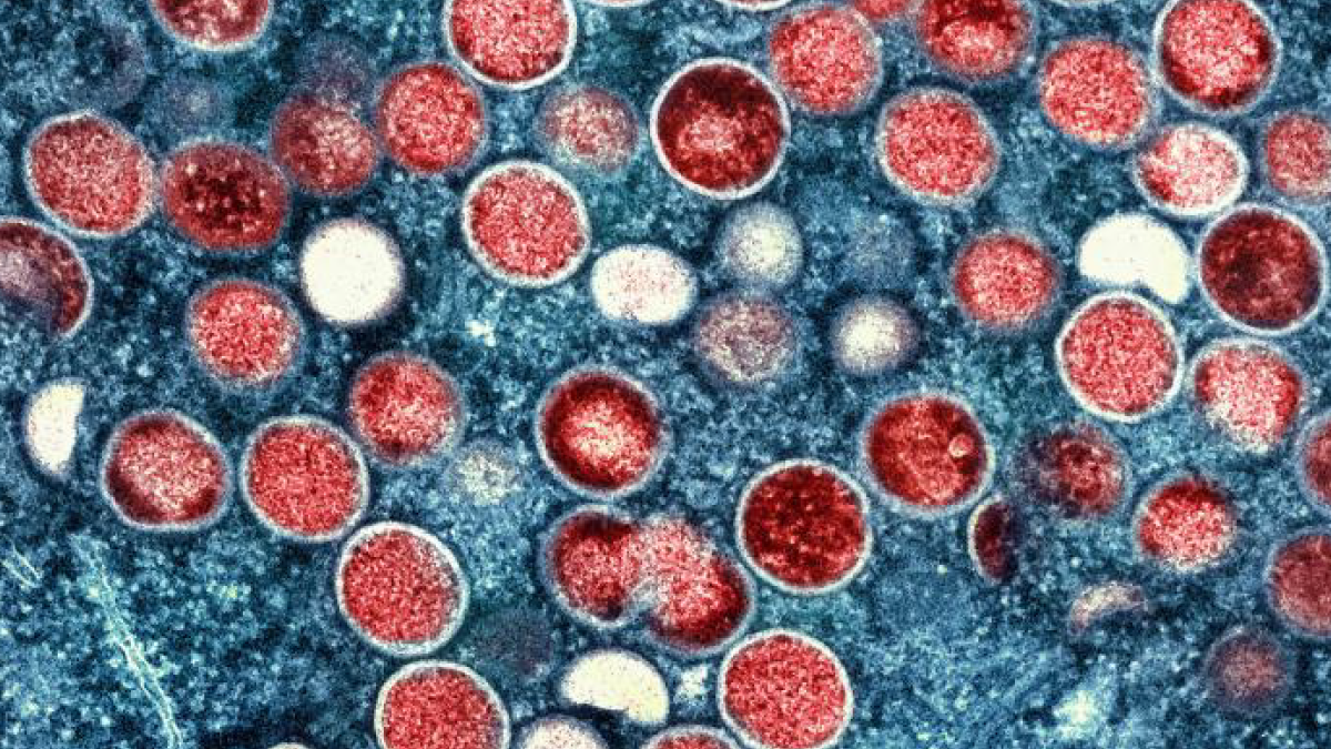 Use of JYNNEOS (Smallpox and Mpox Vaccine, Live, Nonreplicating) for ...