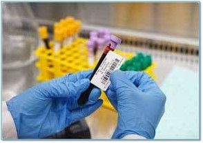 Sample Protocol: Post-collection Processing