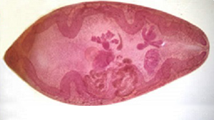 Clinical Overview of Paragonimiasis | Paragonimiasis | CDC