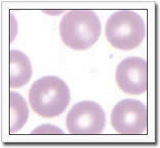 Untitled Document [www.cdc.gov]