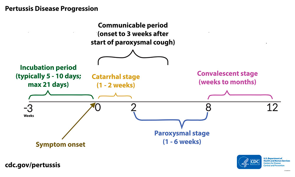 Pertussis Whooping Cough Clinical Features CDC Pertussis Whooping Cough Clinical Features CDC