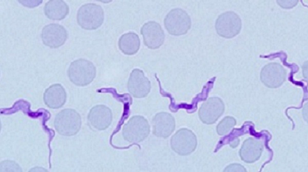 About Sleeping Sickness | Sleeping Sickness (African Trypanosomiasis) | CDC