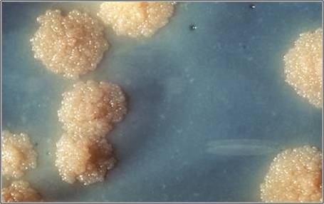 5. Bacteriological Examination – Culture