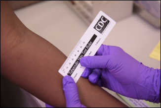 TB Skin Test (Mantoux Tuberculin Skin Test [TST]) (3/5)