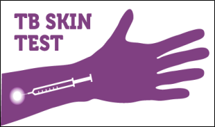 Testing for TB Infection