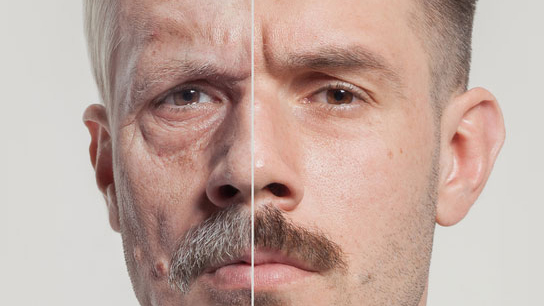 Case Definitions: Cataract | Vision and Eye Health Surveillance System ...