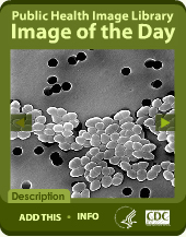 CDC - Public Health Image Library Image of the Day (Green) - Widgets ...
